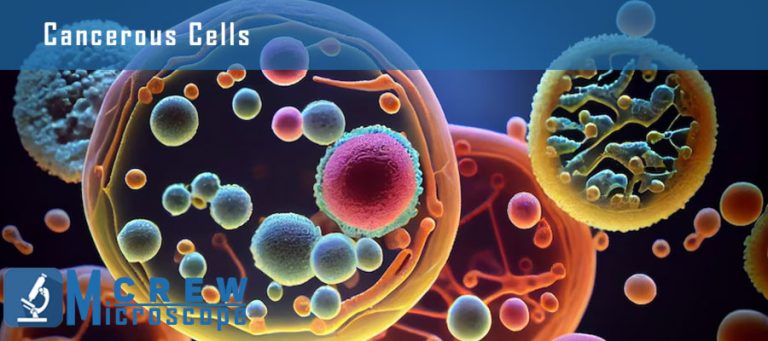 How to Identify Cancer Cells Under a Microscope - Microscope Crew
