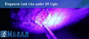 What Does Ringworm Look Like Under a Microscope - Microscope Crew
